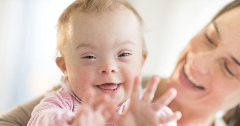 Información y Características del Síndrome de Down